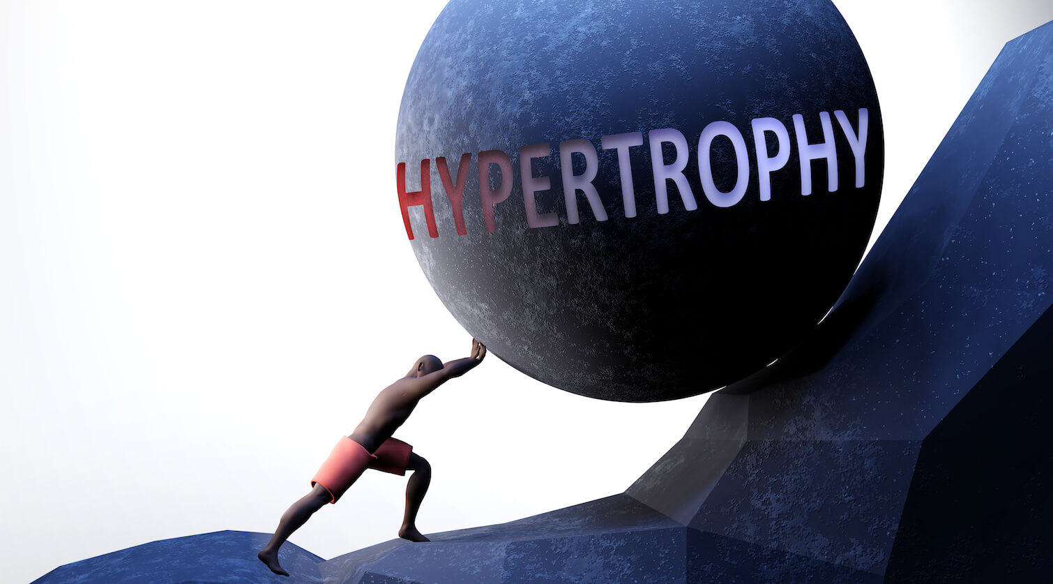 Hypertrophy, health, longevity, and a dilemma - CISN